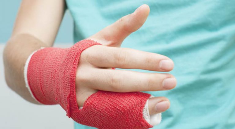 Entorse de doigt - CDHBY